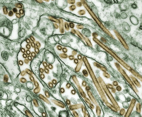 Biopsia intestinal: Clasificación escala de Marsh. - SEVILLA SIN GLUTEN
